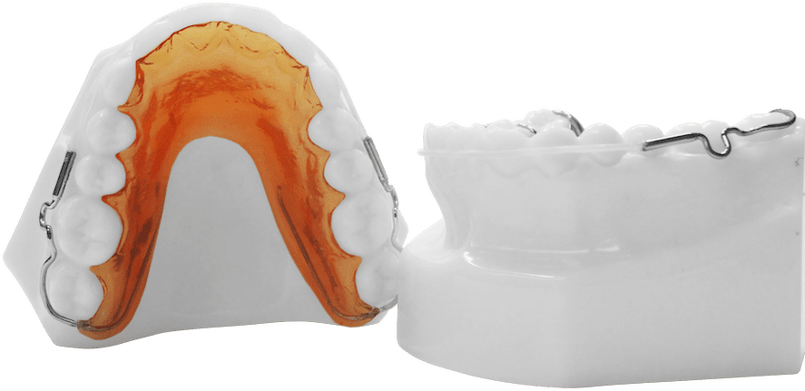 Retainers | Ricoh Orthodontic Appliances